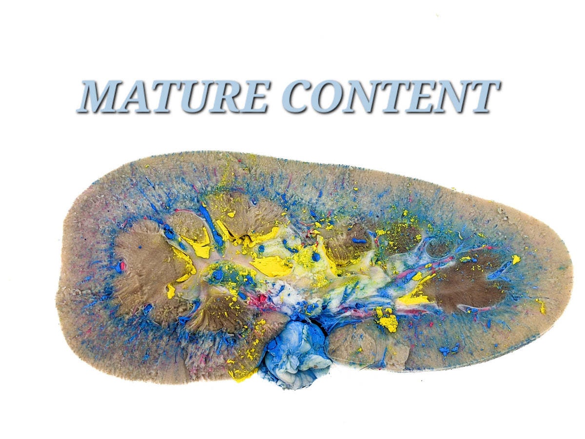 1/2 Pig Kidney Triple injected Wet Specimen – Scenic City Oddities